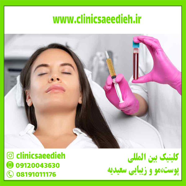 PRX - کلینیک پوست و مو زیبایی سعیدیه